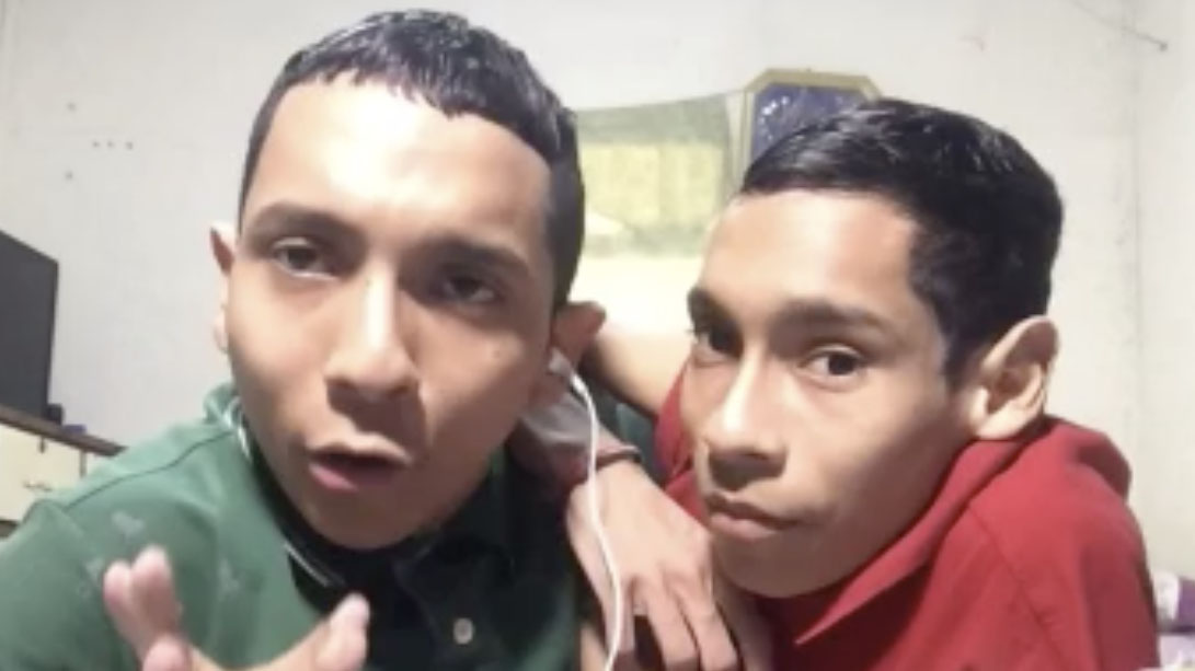 Hermanos de Ecuador, los siameses que hace 21 años que comparten sus ...