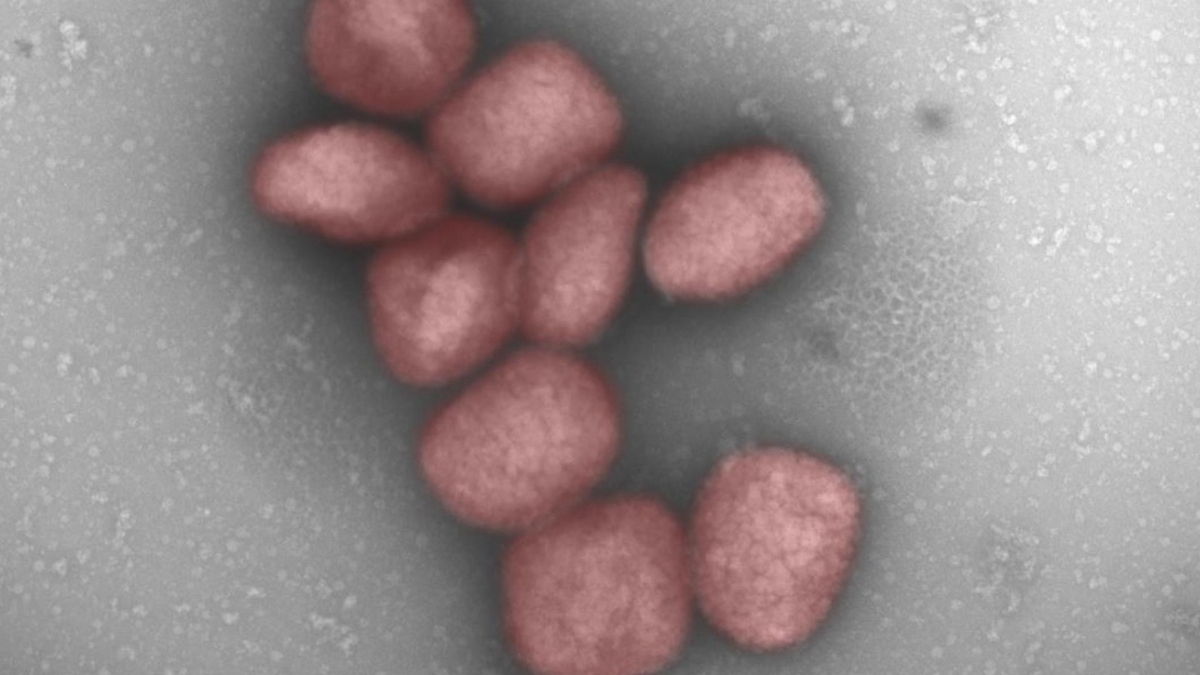 Virus de la viruela del mono podría transmitirse por vía aérea ...