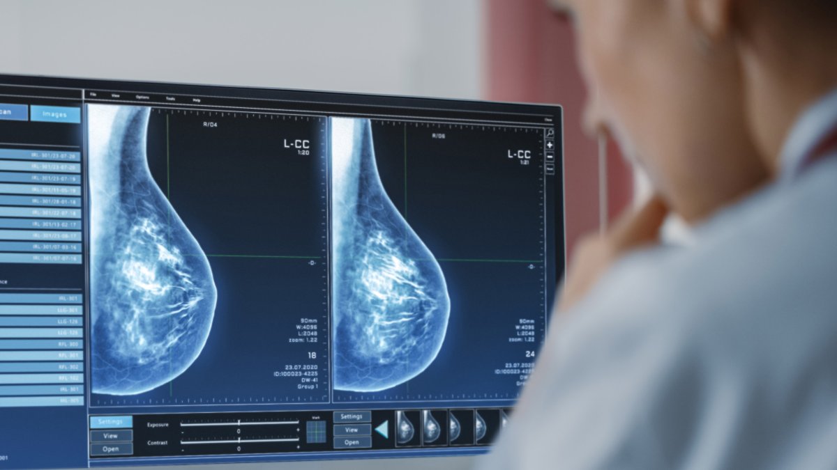 Nuevas guías para realizarse pruebas de detección de cáncer de mama – Telemundo New York (47)